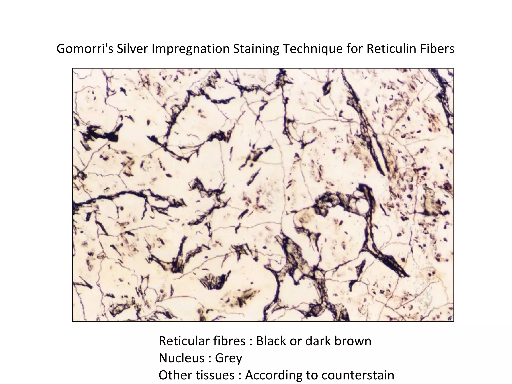 Silver Staining | PPT | Chemistry | Science