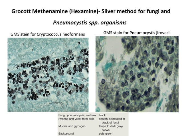 Silver Staining | PPT | Chemistry | Science