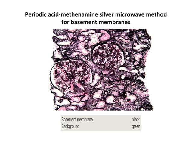 Silver Staining | PPT
