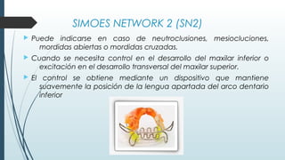 Simões network (sn) | ODP