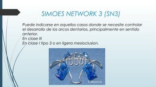 Simões network (sn) | ODP