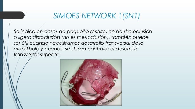Simões network (sn)