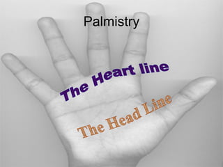 Simian line/crease | PPT