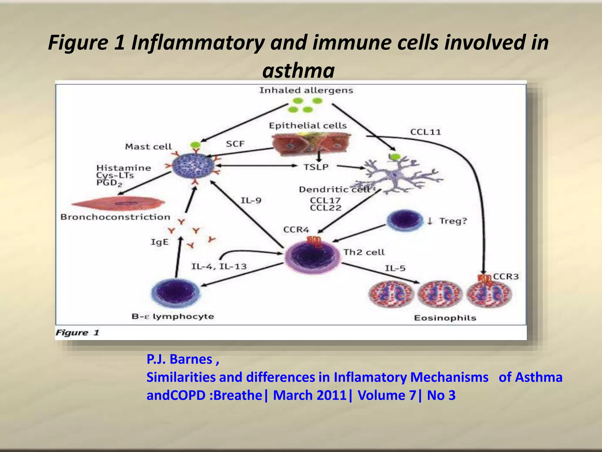 Similarities and differences between asthma and asthma masqueraders | PPTX