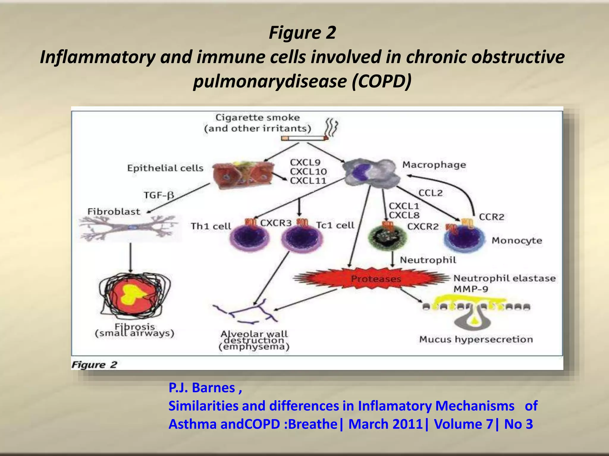 Similarities and differences between asthma and asthma masqueraders | PPTX