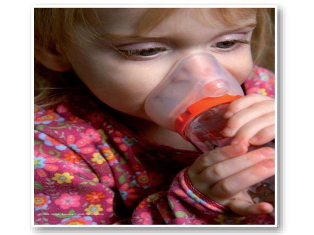 Similarities and differences between asthma and asthma masqueraders ...