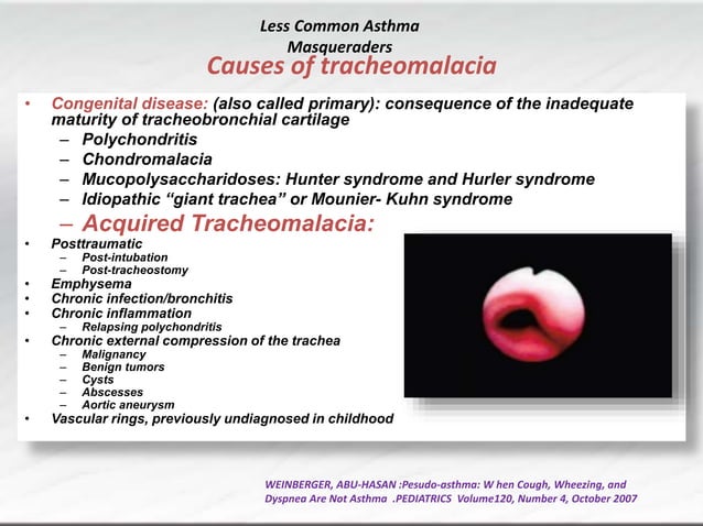 Similarities and differences between asthma and asthma masqueraders ...