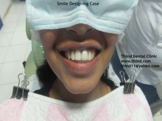 Simile designing case | PPT