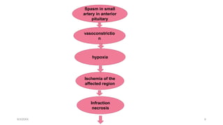 Simmonds Disease | PPTX