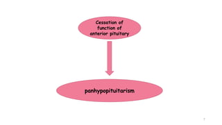 Simmonds Disease | PPTX