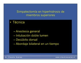 Simpatectomia Videotoracoscopica | PDF