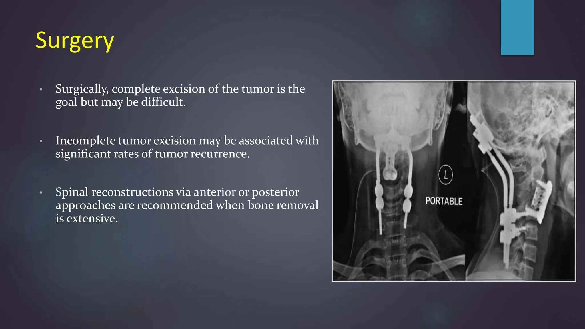 Simple and aneurysmal Bone cyst - Definition, Classfication ...