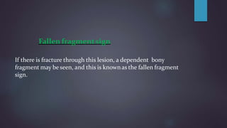 Simple and aneurysmal Bone cyst - Definition, Classfication ...