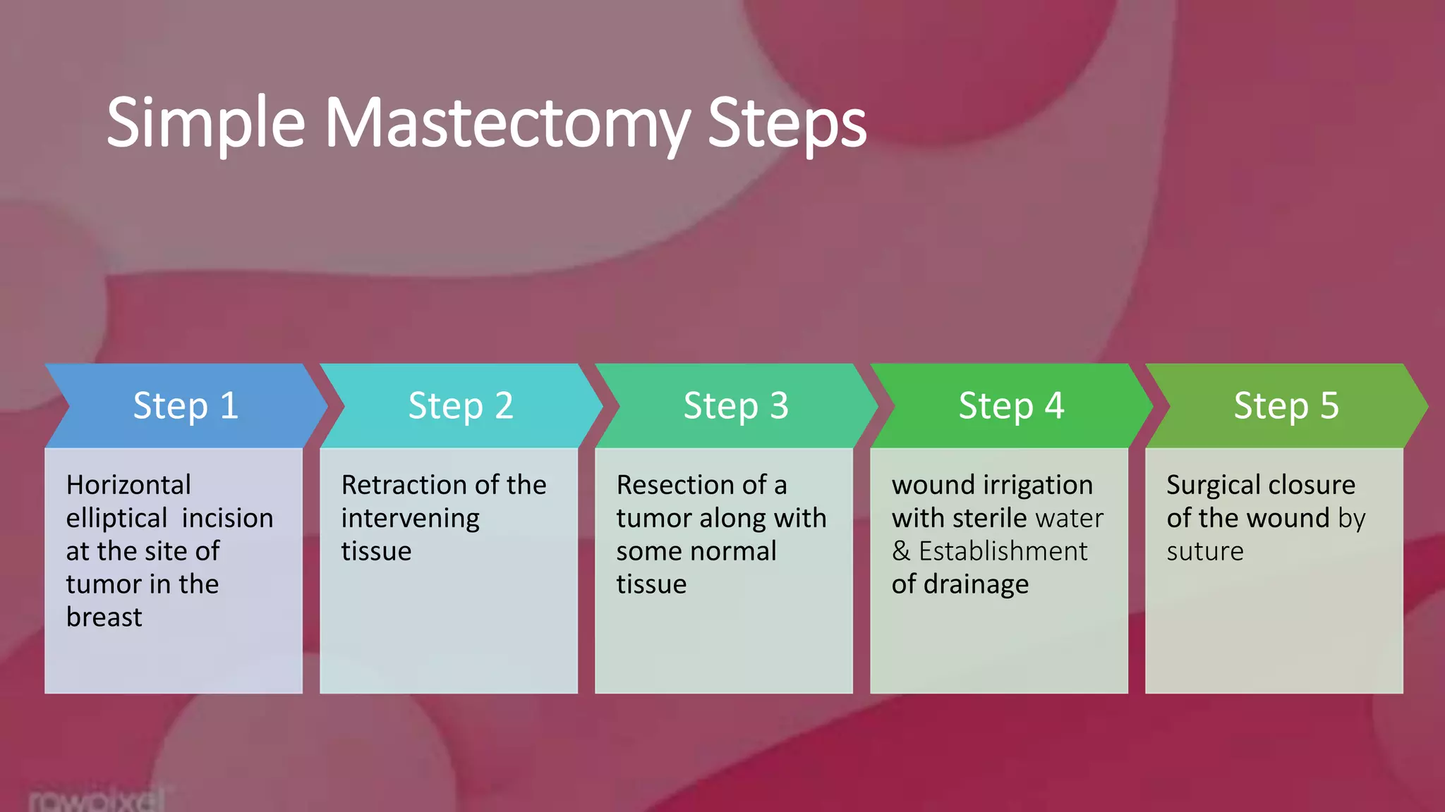 simple and radical mastectomy.pptx