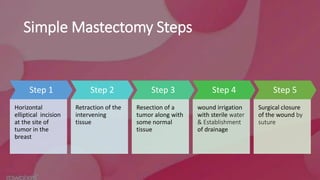 simple and radical mastectomy.pptx
