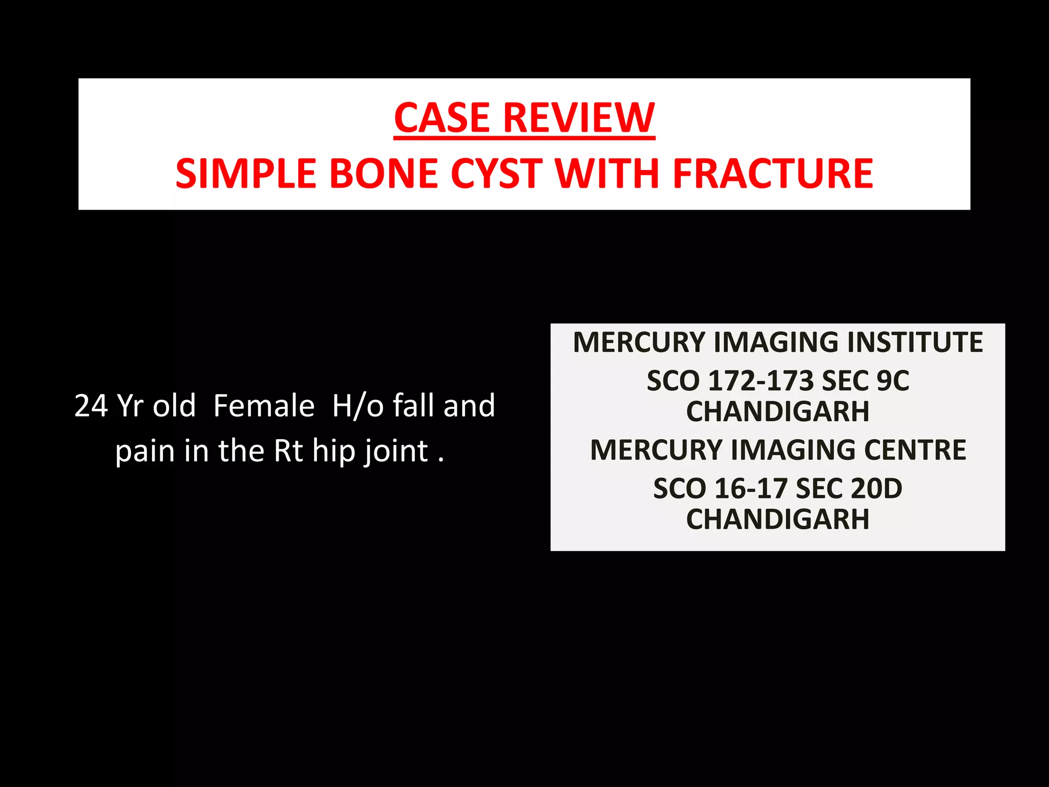 Simple bone cyst | PPTX