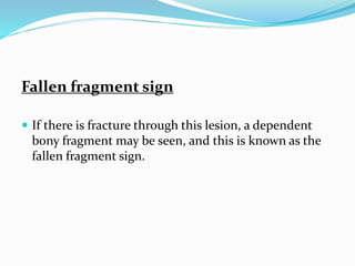 Simple bone cyst | PPTX