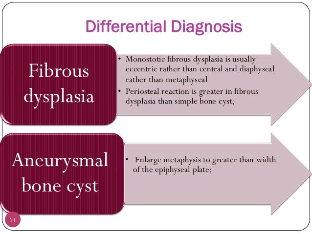 Simple bone cyst (unicameral)