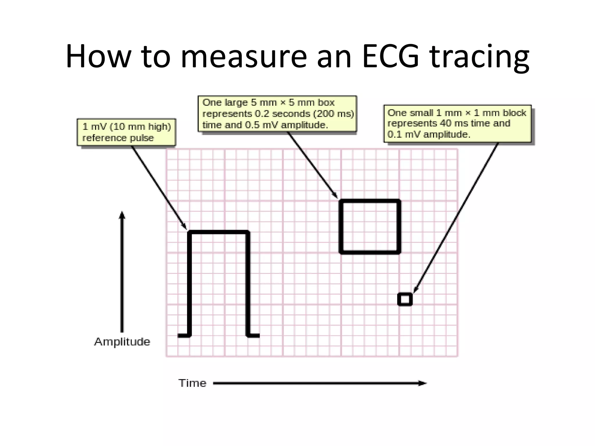 simple ecg learningMEM.pptx