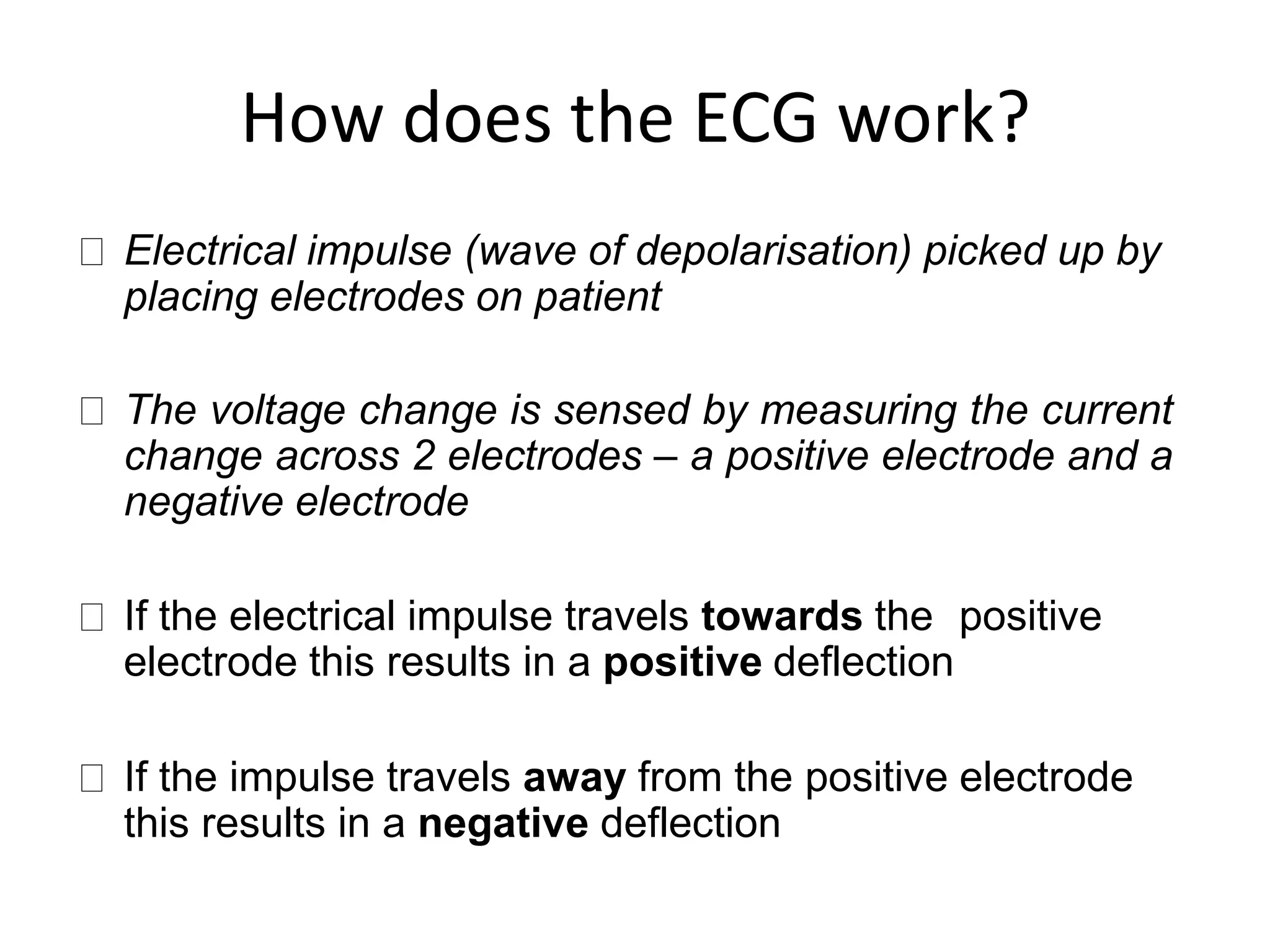 simple ecg learningMEM.pptx