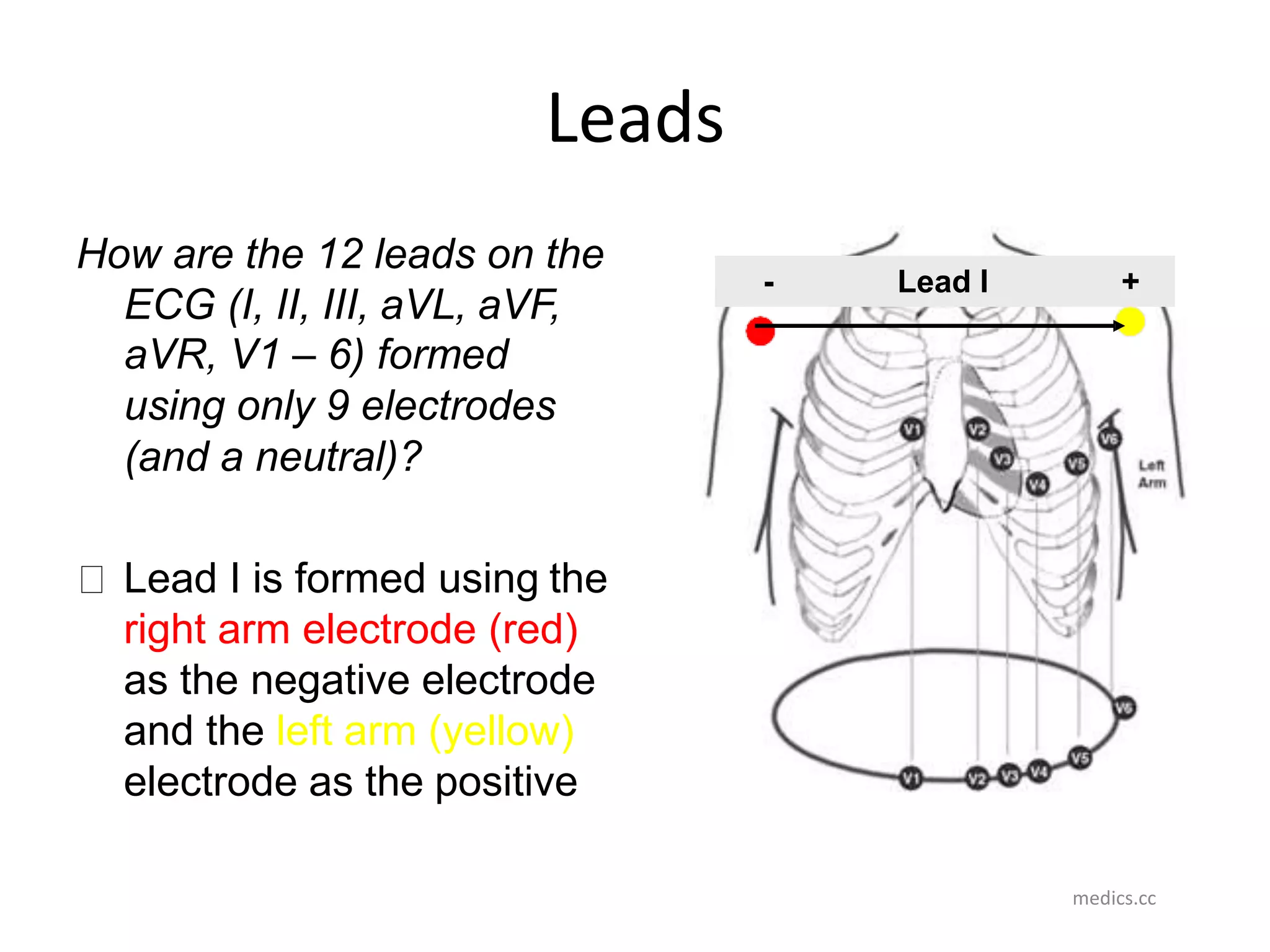 simple ecg learningMEM.pptx