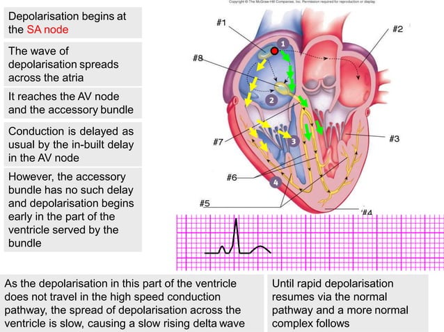 simple ecg learningMEM.pptx