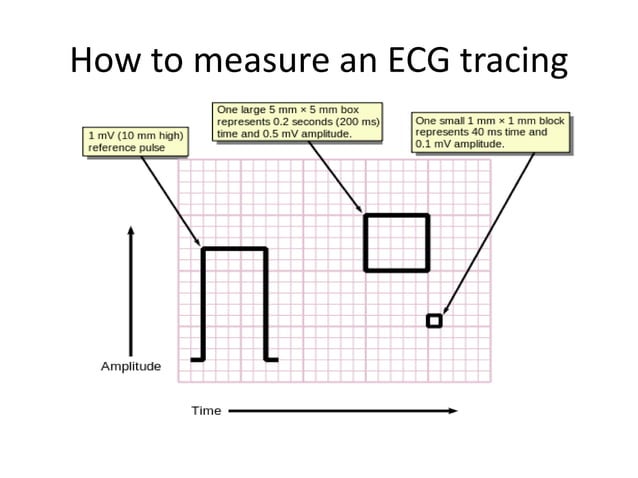 simple ecg learningMEM.pptx