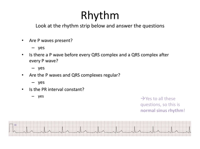 simple ecg learningMEM.pptx