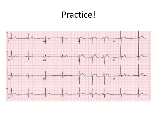simple ecg learningMEM.pptx