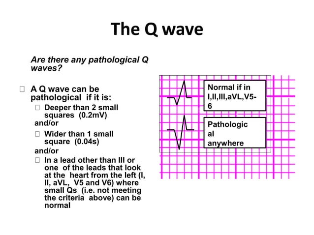 simple ecg learningMEM.pptx