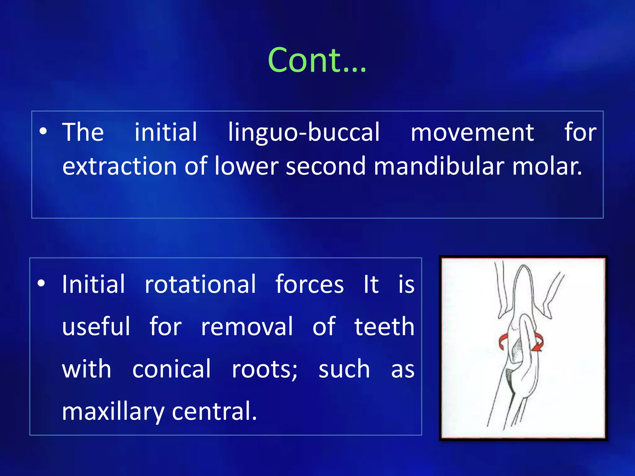 Simple tooth extraction technique | PPTX
