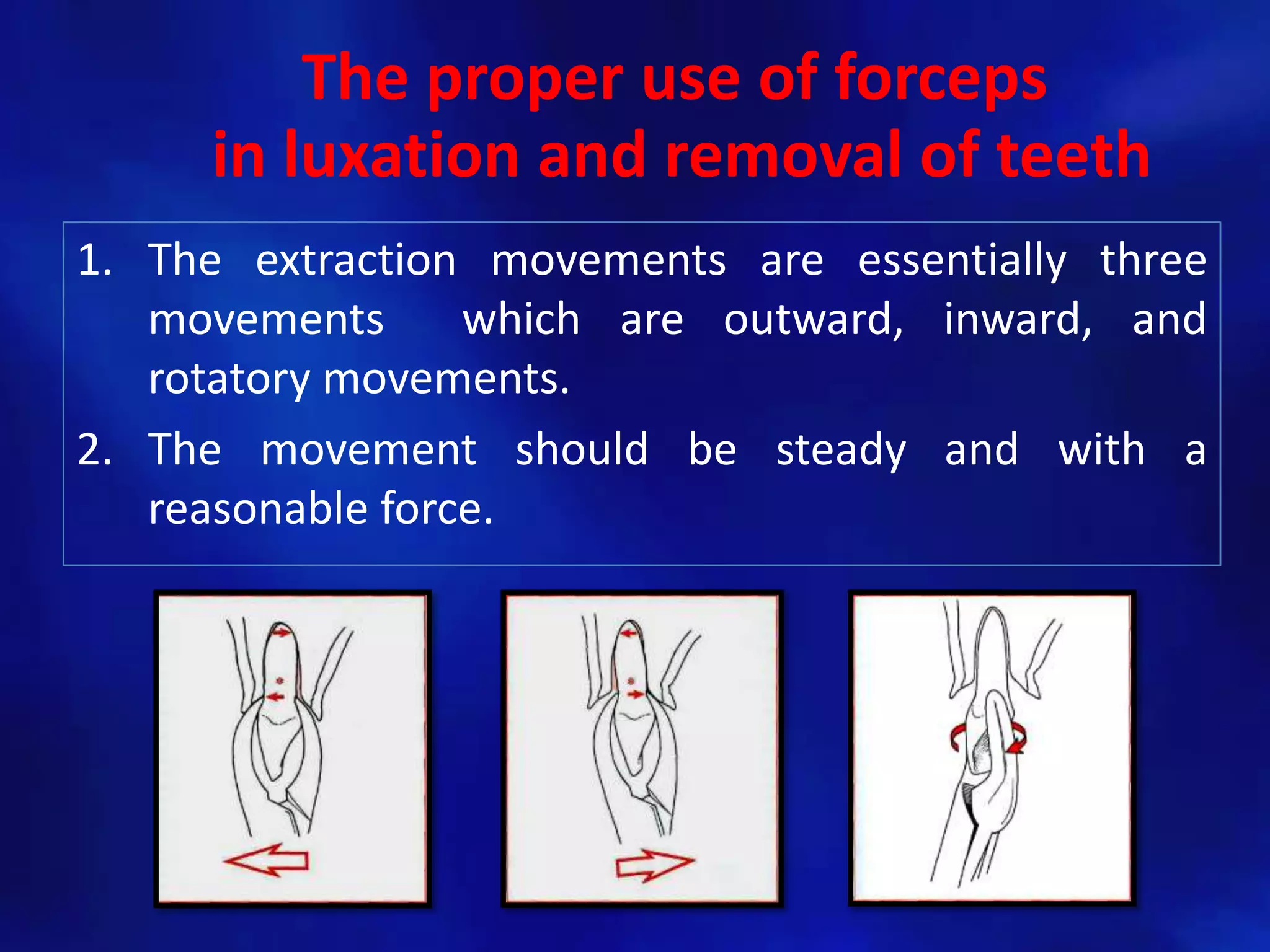 Simple tooth extraction technique | PPTX