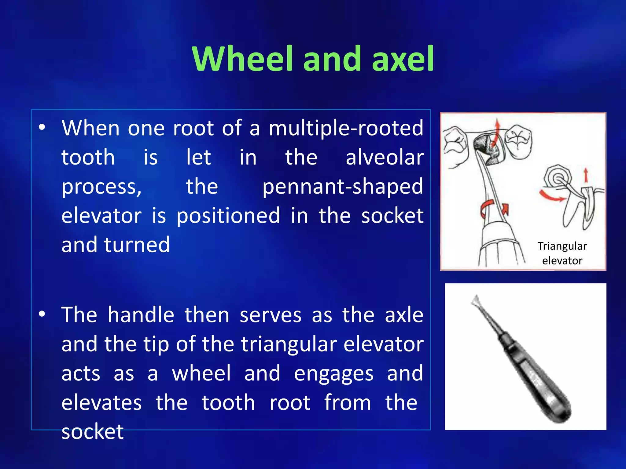 Simple tooth extraction technique | PPTX