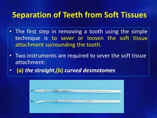Simple tooth extraction technique | PPTX