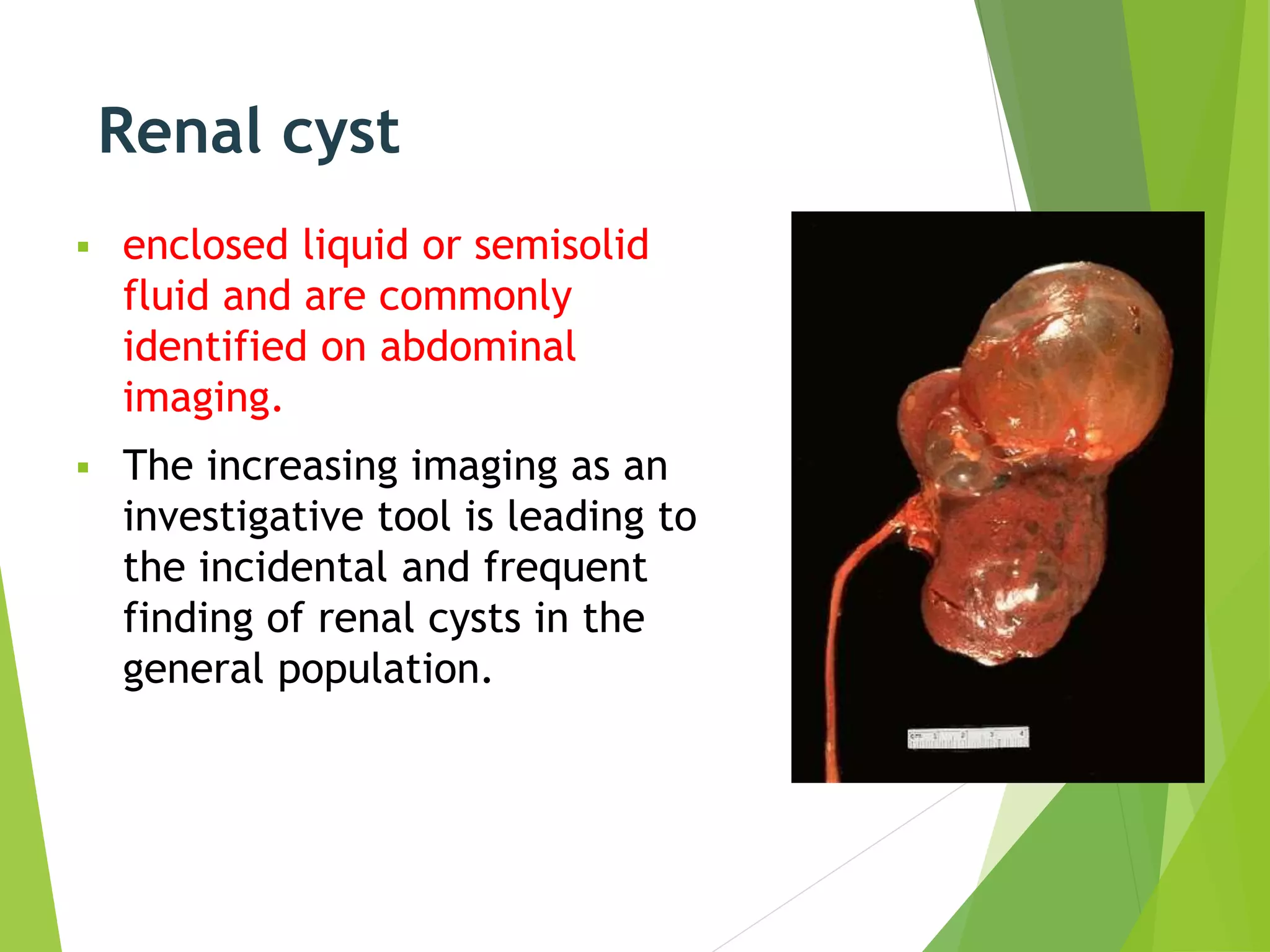 Simple renal cysts | PPTX