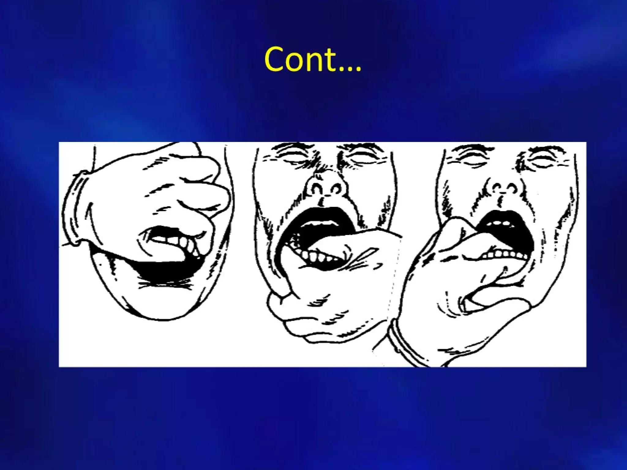 Simple tooth extraction | PPT