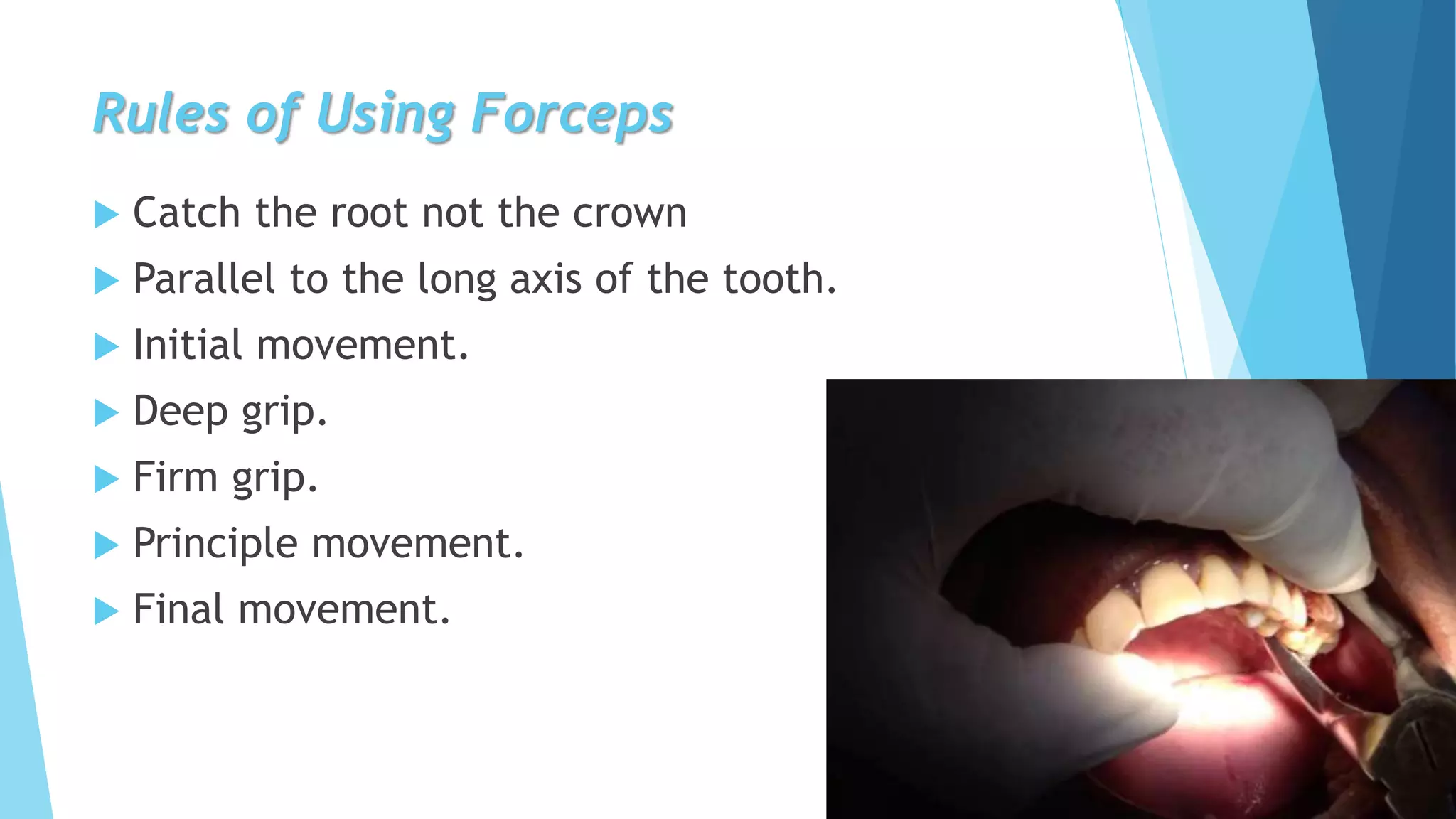 Tooth Extraction Simple Technique | PPTX