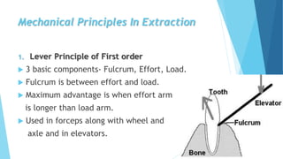 Tooth Extraction Simple Technique | PPTX