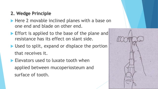 Tooth Extraction Simple Technique | PPTX | Dental Health | Diseases and ...