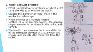Tooth Extraction Simple Technique | PPTX