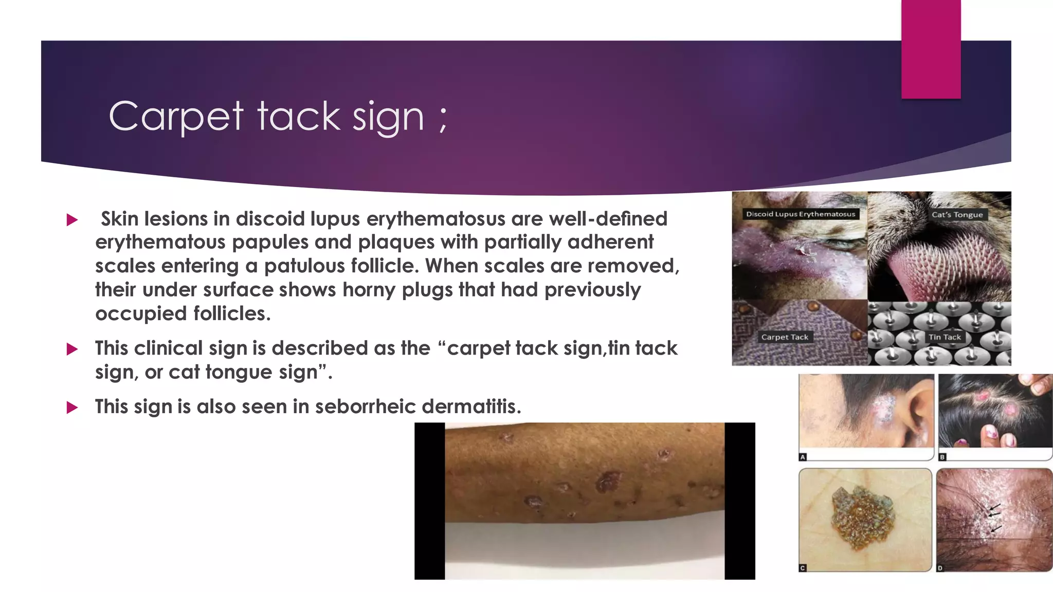 Simplification of Dermatology signs.pdf