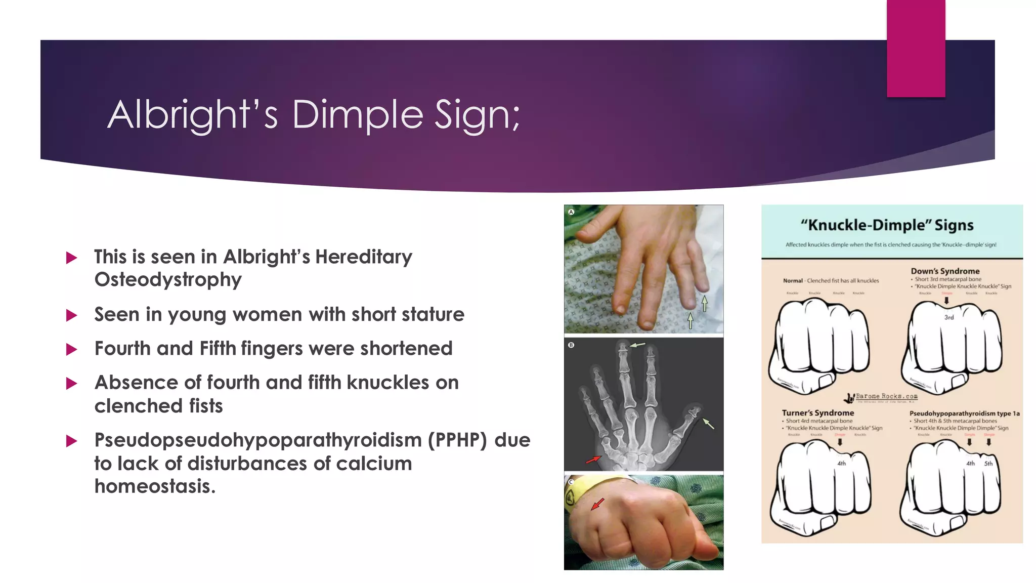 Simplification of Dermatology signs.pdf