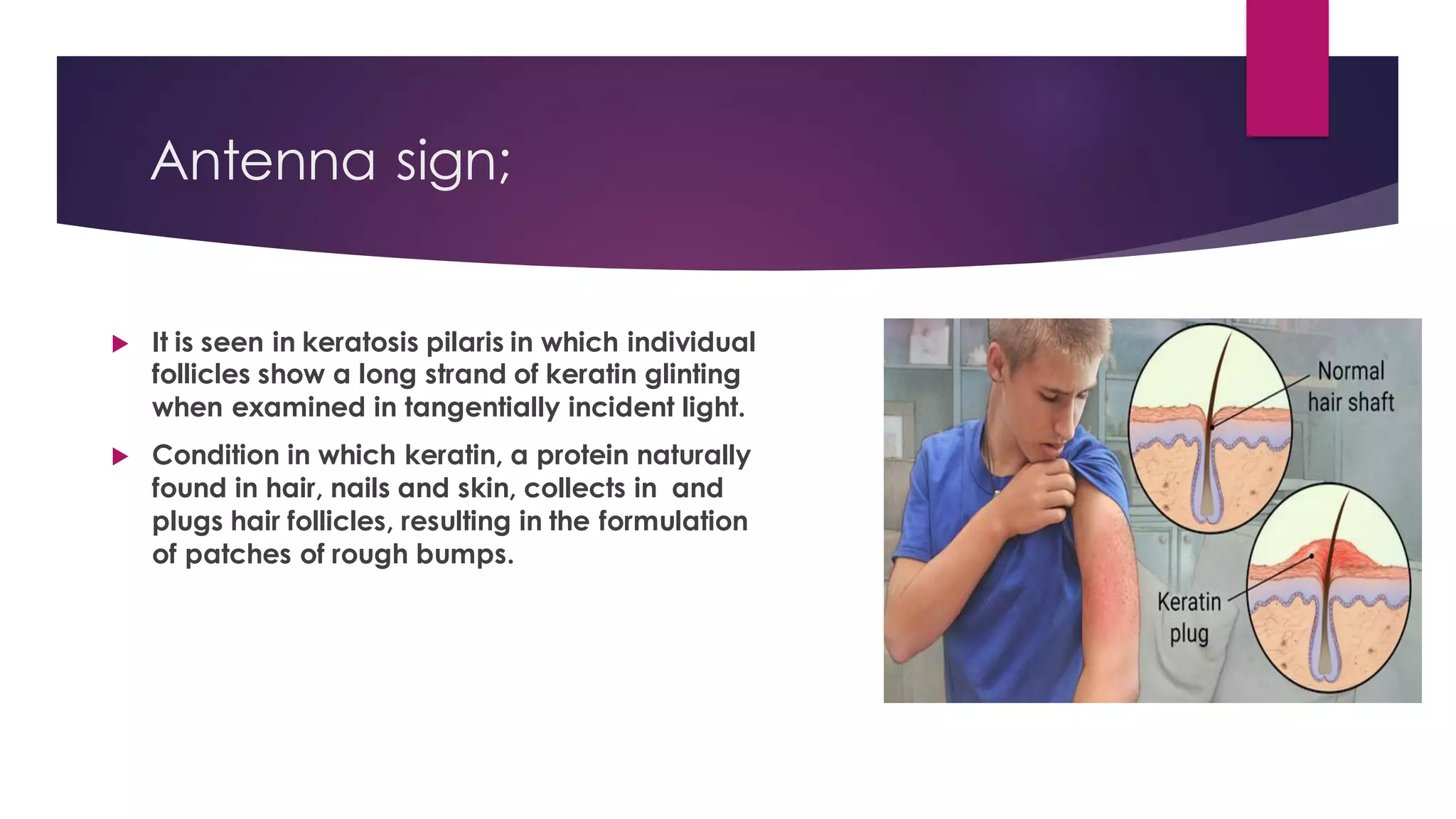 Simplification of Dermatology signs.pdf