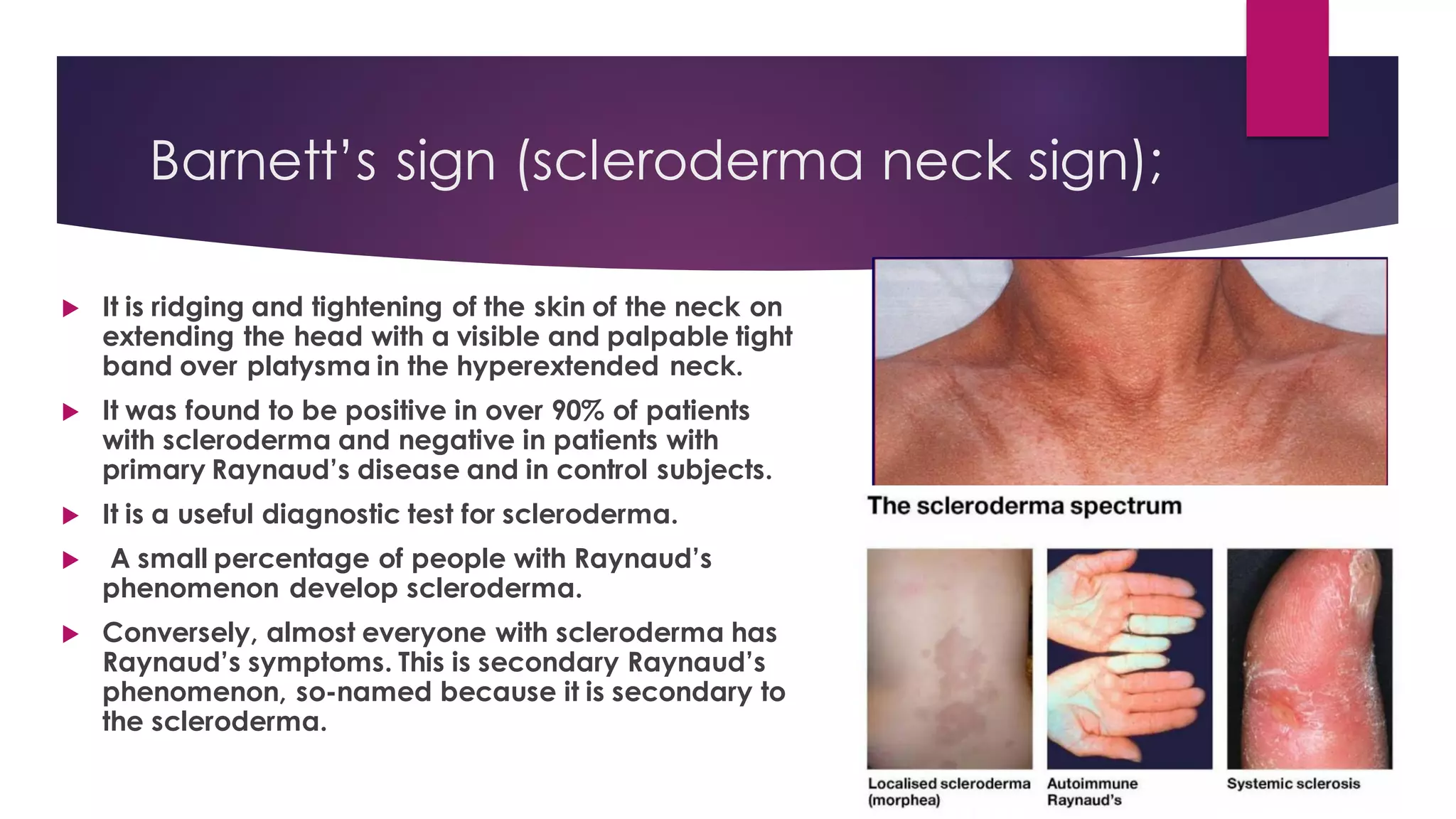 Simplification of Dermatology signs.pdf