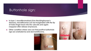 Simplification of Dermatology signs.pdf