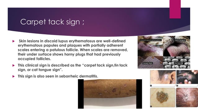 Simplification of Dermatology signs.pdf | Skin and Dermatology ...
