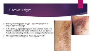 Simplification of Dermatology signs.pdf