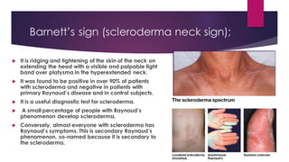 Simplification of Dermatology signs.pdf | Skin and Dermatology ...