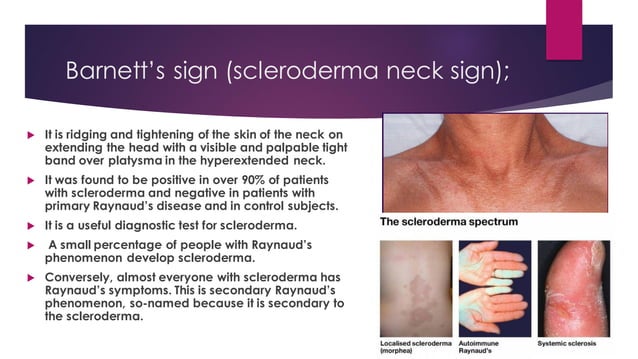 Simplification of Dermatology signs.pdf | Skin and Dermatology ...