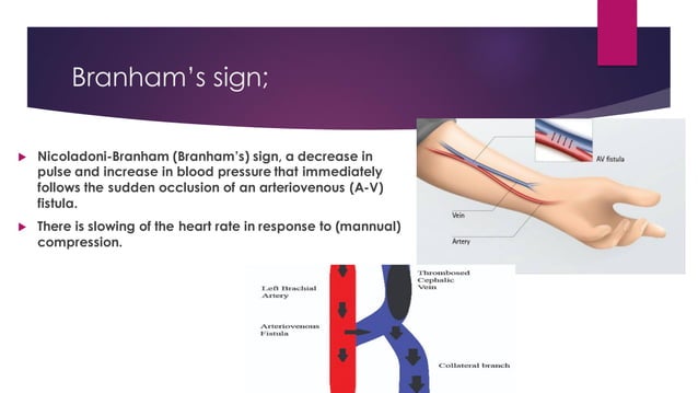 Simplification of Dermatology signs.pdf | Skin and Dermatology ...